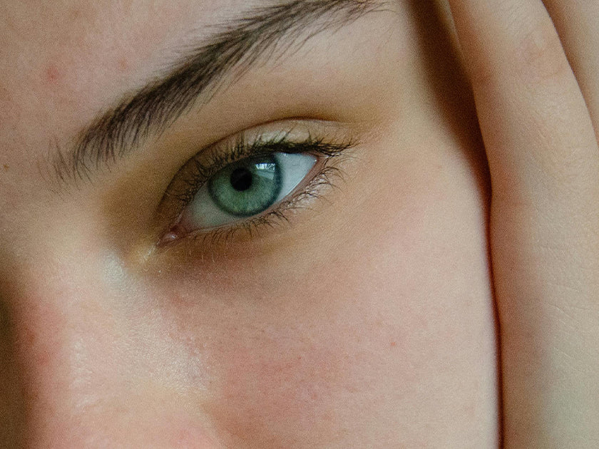 Red Spots on Skin: The Most Common Causes and How to Treat Them – Swisse UK